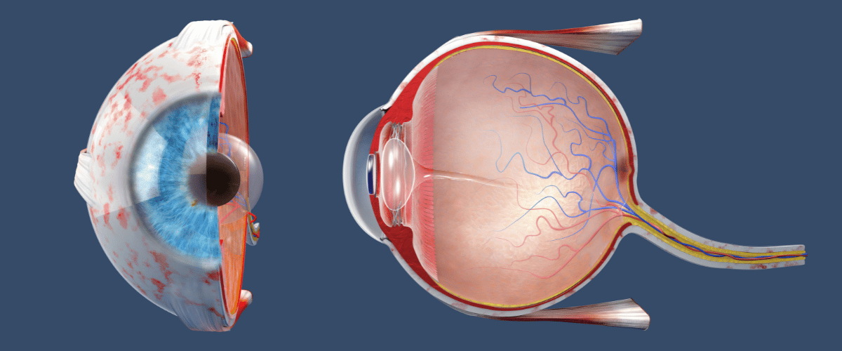 Intraocular (Eye) Melanoma | SERO