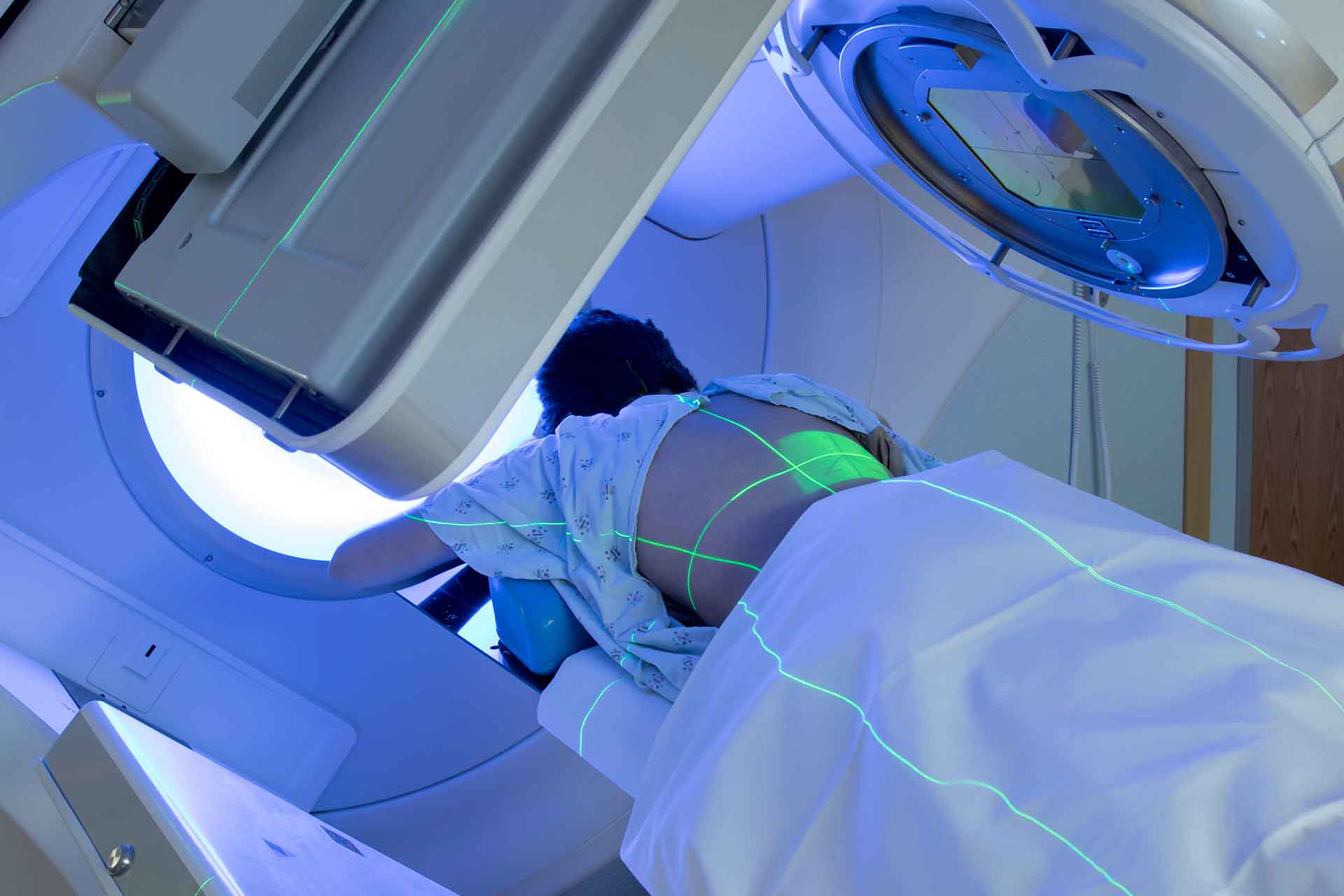 Radiation Therapy & Cancer Treatment: What To Expect | SERO